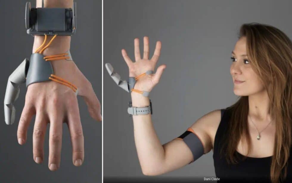 Woman creates 'third thumb' and it's a total gamechanger